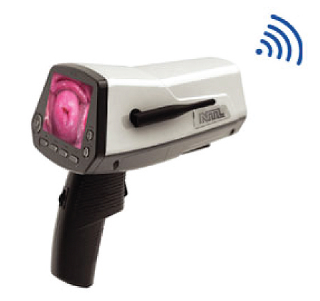 Remote Cervical Cancer Screening - Korean-Products.com